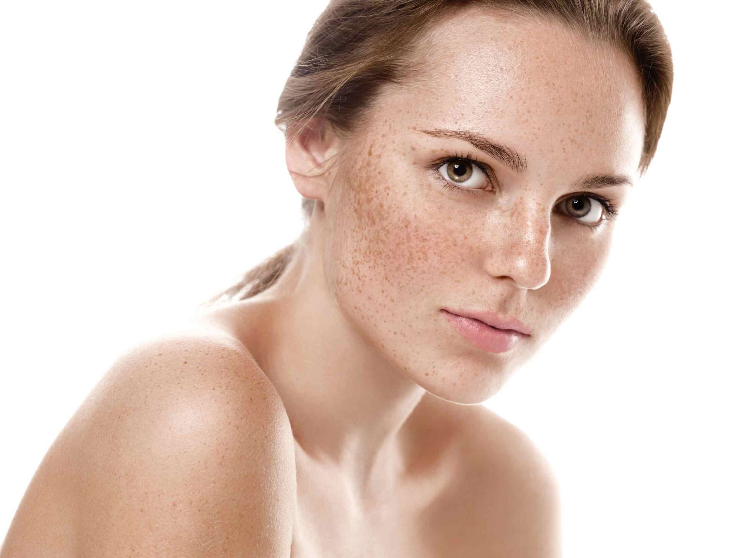 Demystifying Pigmentation: Types, Causes, and Treatment Options – AURA